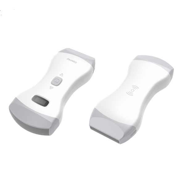 Portable Ultrasound Probe for Iphone Black Friday Deals