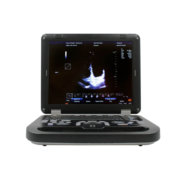 Portable Ultrasound Color Doppler Machine