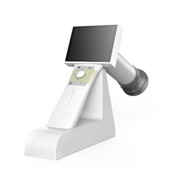 Digital Portable Hand-Held Eye Fundus Camera High Definition Imaging